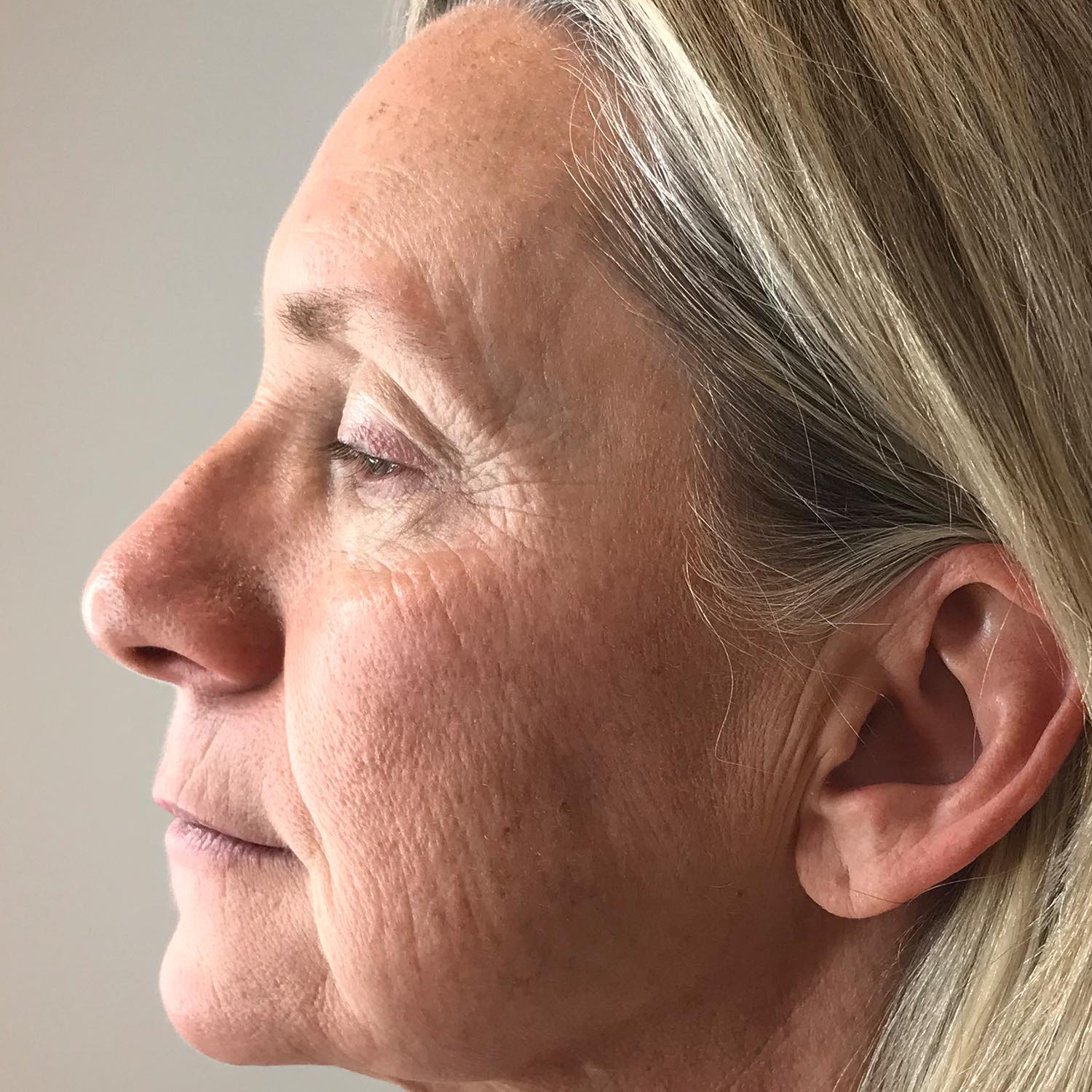 Injectables – Avery Graham