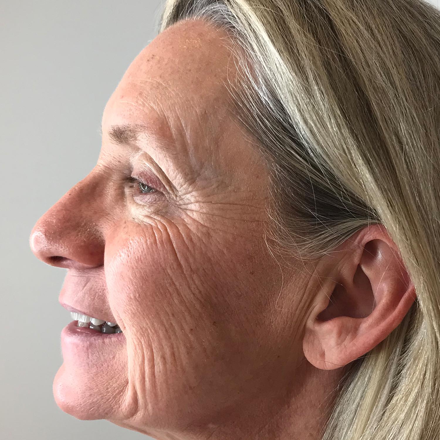 Injectables – Avery Graham